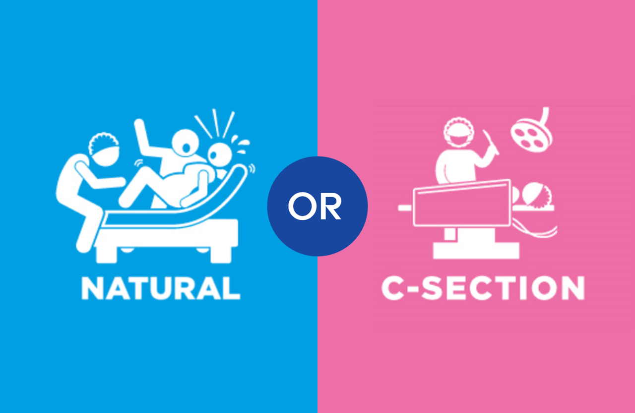 Choosing Between Natural C Section Delivery Aptamil Singapore