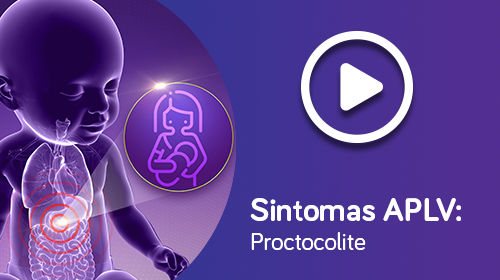 Sintomas APLV: Proctocolite